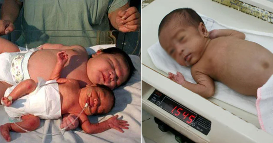 Sự khác biệt giữa trẻ sinh ra 2kg, 3kg và hơn 4kg: 3kg là mức cân nặng khiến bạn giật mình